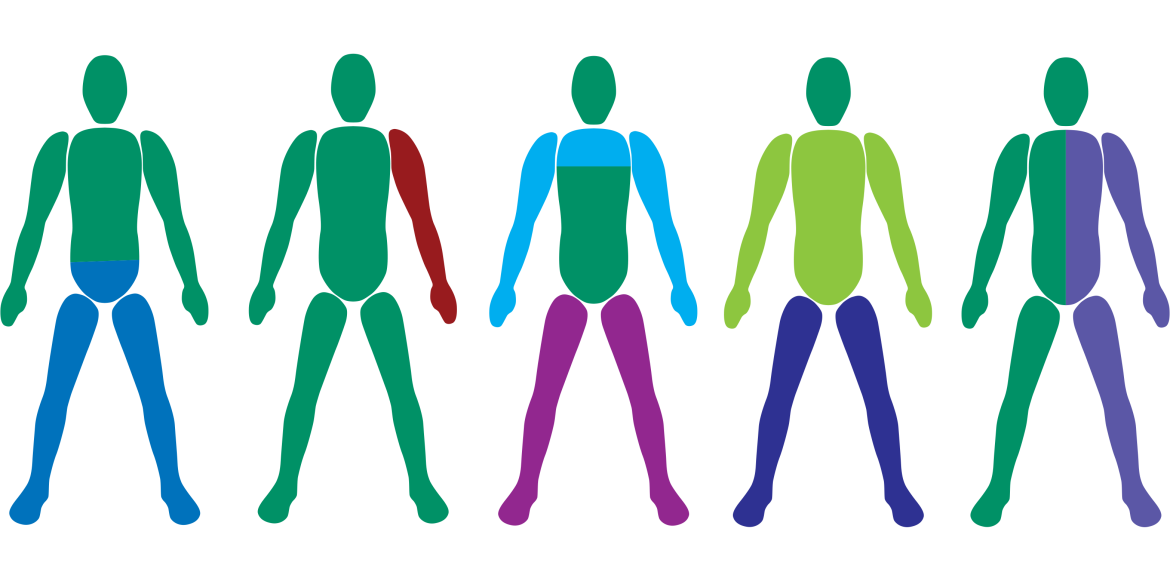 Alternative Designs – Parasport Classification – LEXI